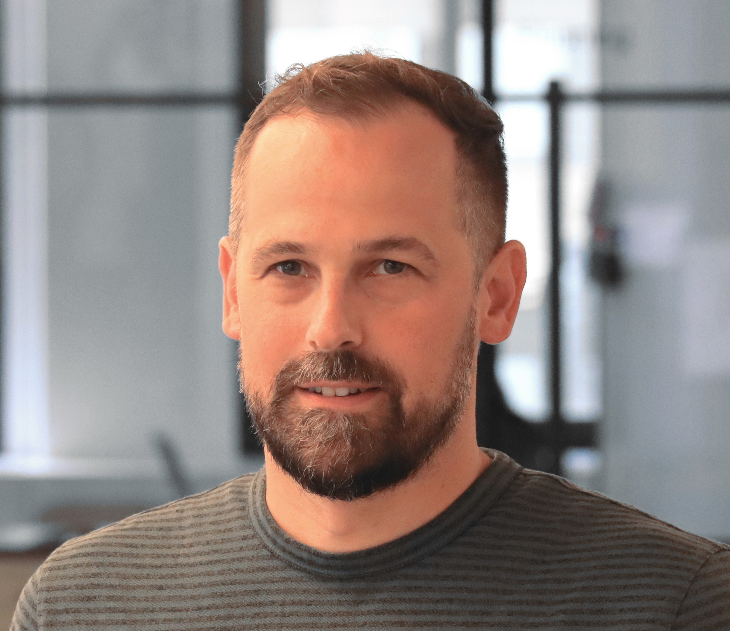 Real 2 Headed Person